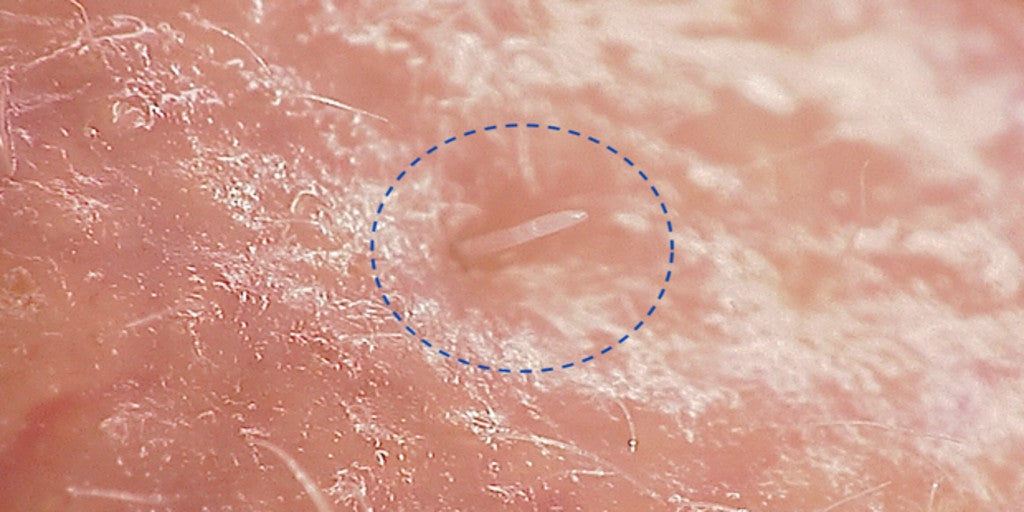 The Bugs That Live On Your Face And Mate While You Sleep Time News