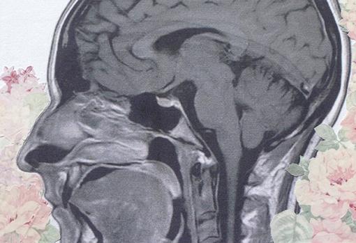 Bárbara Muriel: «La cicatriz es para mí un lugar de reconocimiento»